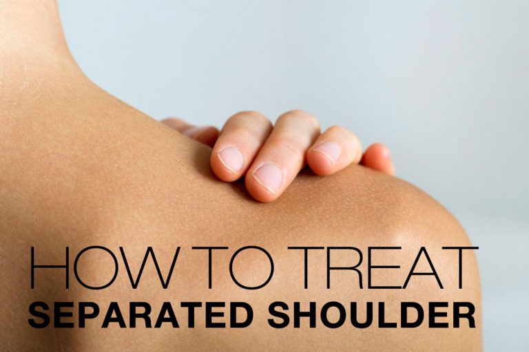 Shoulder Separation: Symptoms, Causes, Treatment By Shoulder Separation Braces