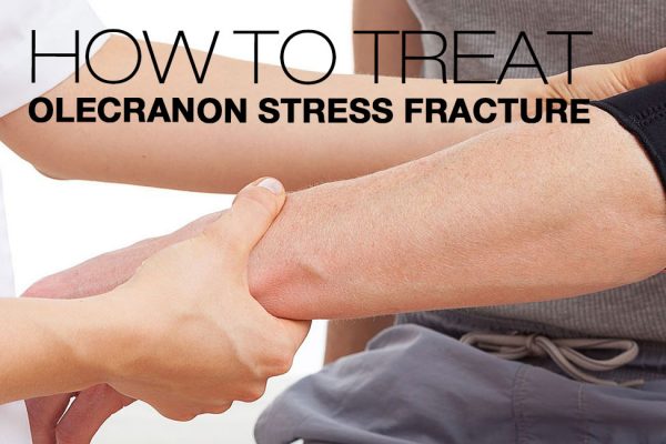 Olecranon Stress Fracture: Symptoms, Causes, Treatment By Elbow Braces
