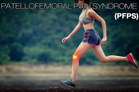 What Is Patellofemoral Pain Syndrome (PFPS)? - WorldBrace