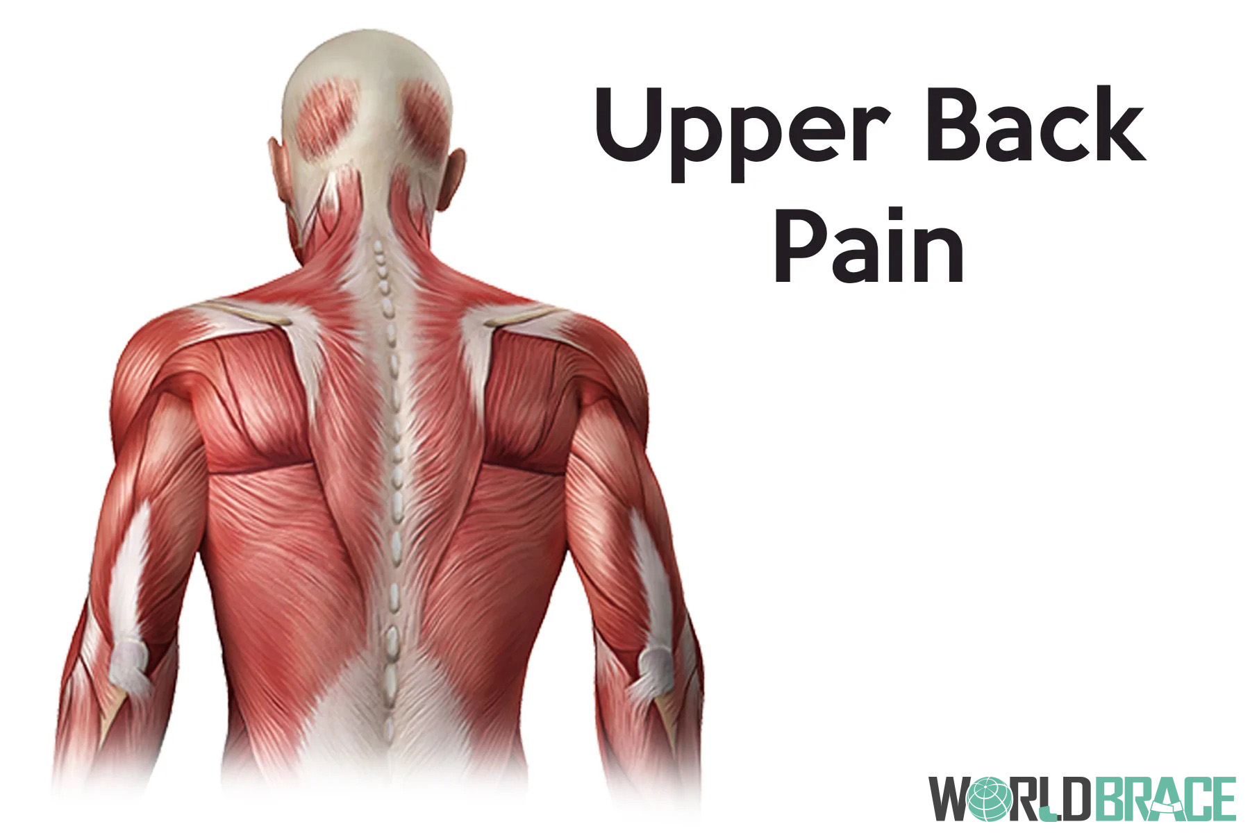 Thoracic Upper Back & Spine Pain Braces - WorldBrace